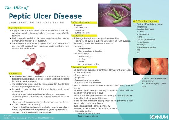 ABCs of: Peptic Ulcer Disease – Surgical Interest Group of Monash ...