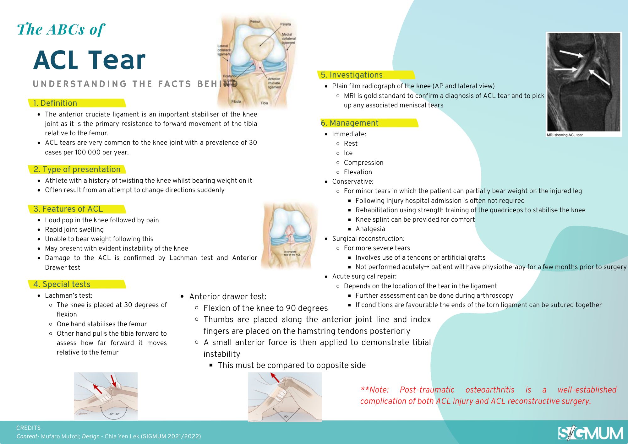 ABCs of: ACL Tears – Surgical Interest Group of Monash University Malaysia