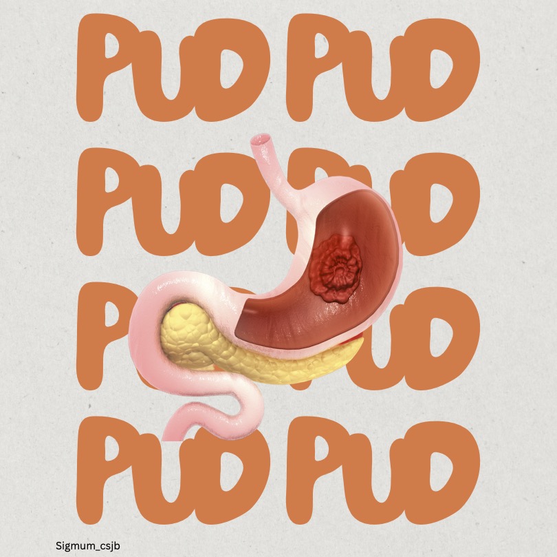 Peptic Ulcer Disease – Surgical Interest Group of Monash University ...